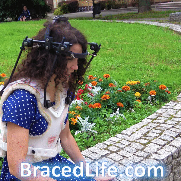 Victorias Halo Brace Summer Is On Our Patreon By Medicbrace On Deviantart