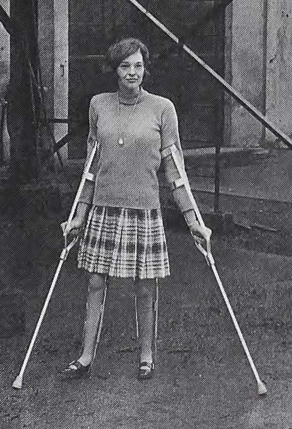 Polio Braces Crutches By Lfitz On Deviantart