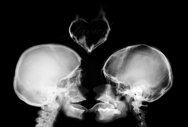 X Ray Kiss By Javick On Deviantart