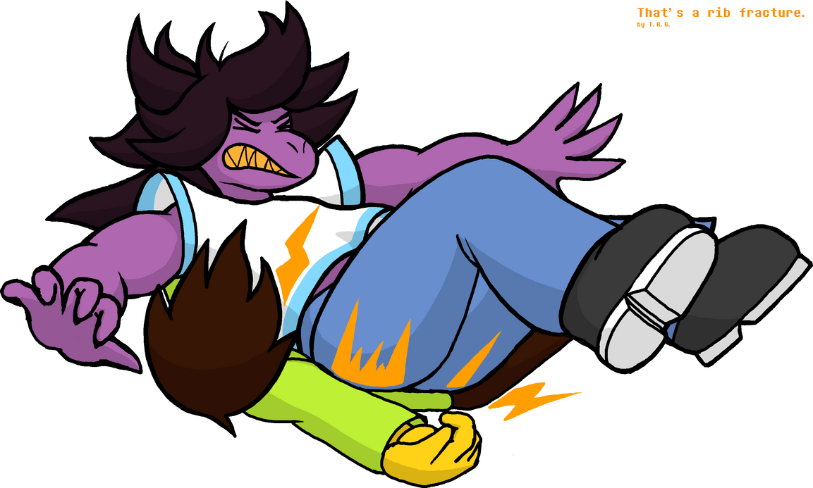 Rib Fractures By Viennacalling92 On Deviantart