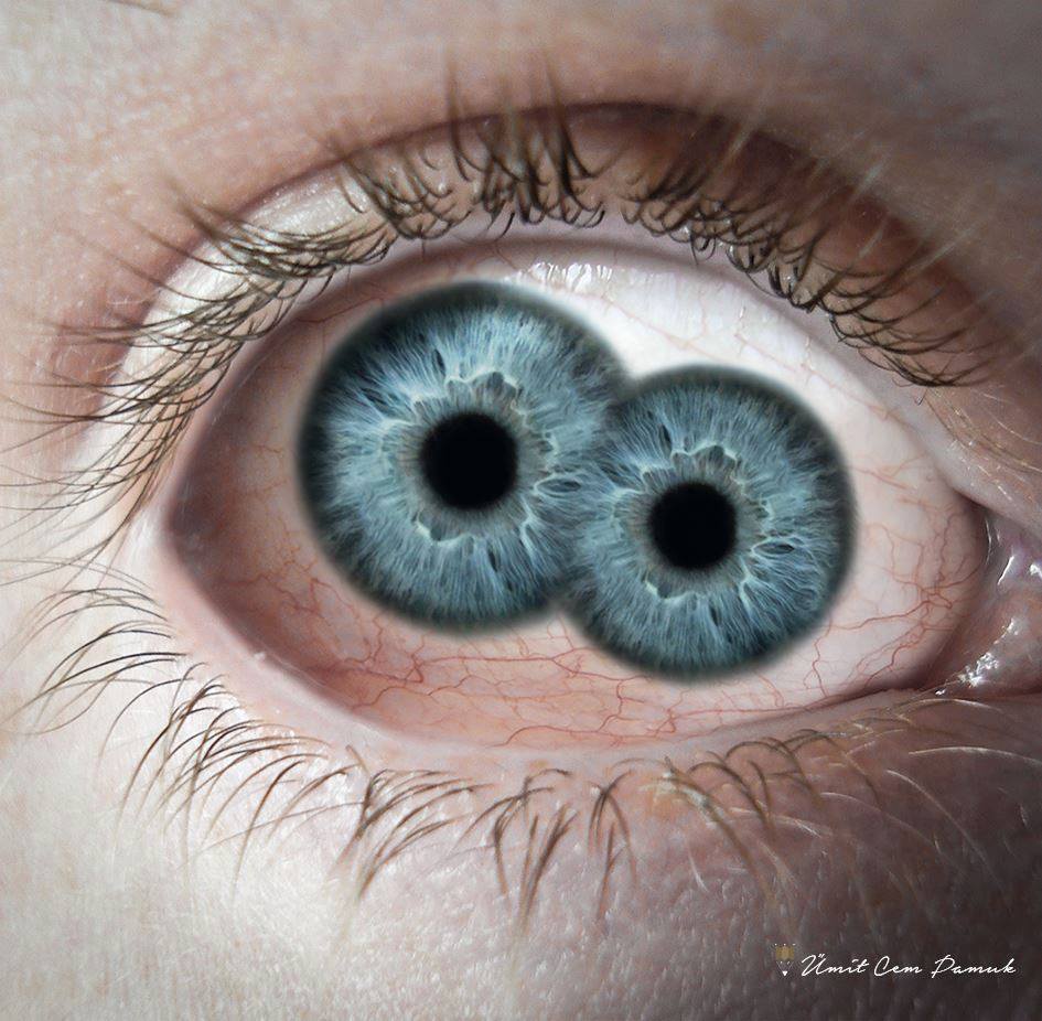 Double Pupil Eye