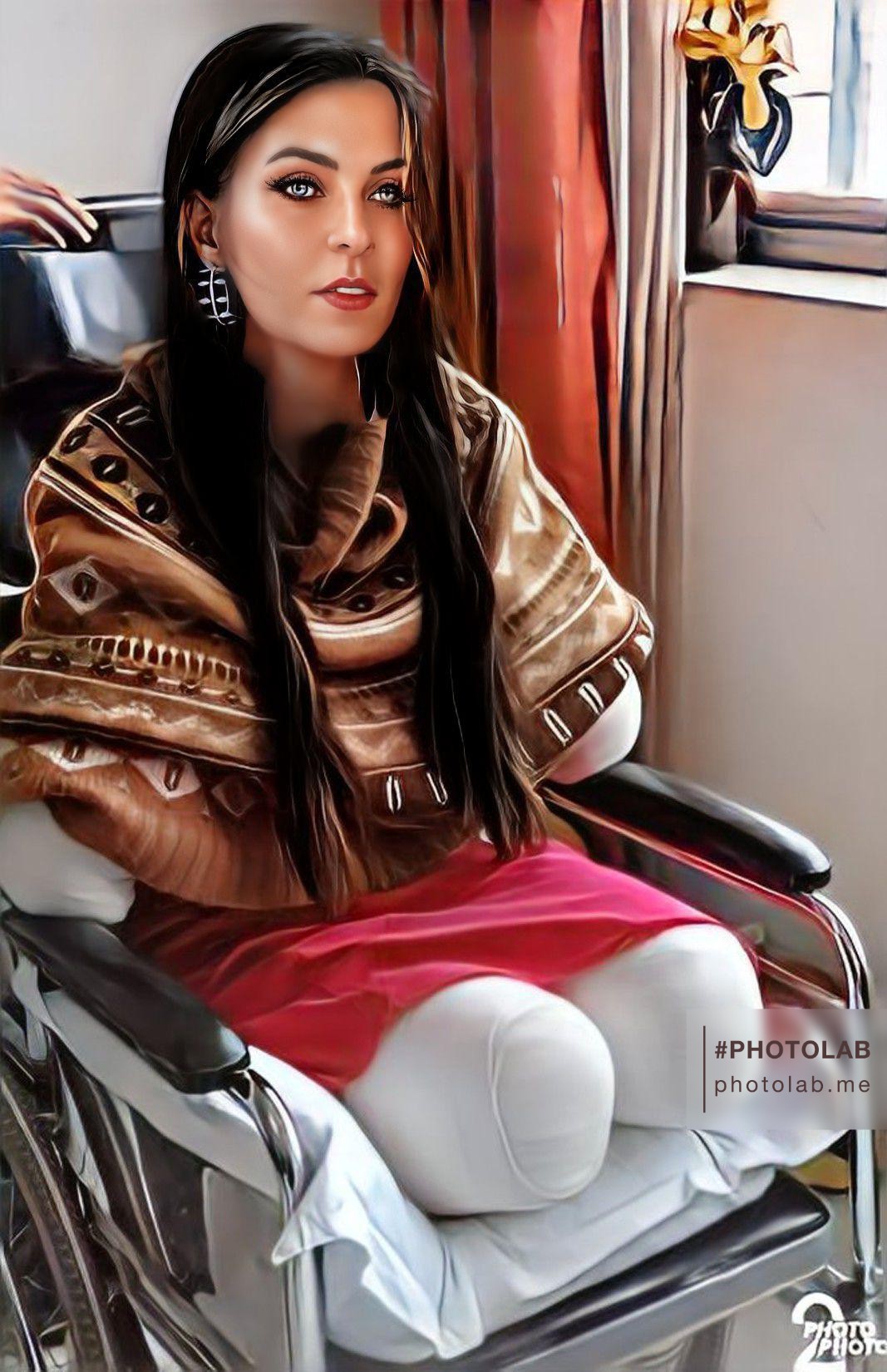 Quad Amputee Pretender By Amputights On Deviantart