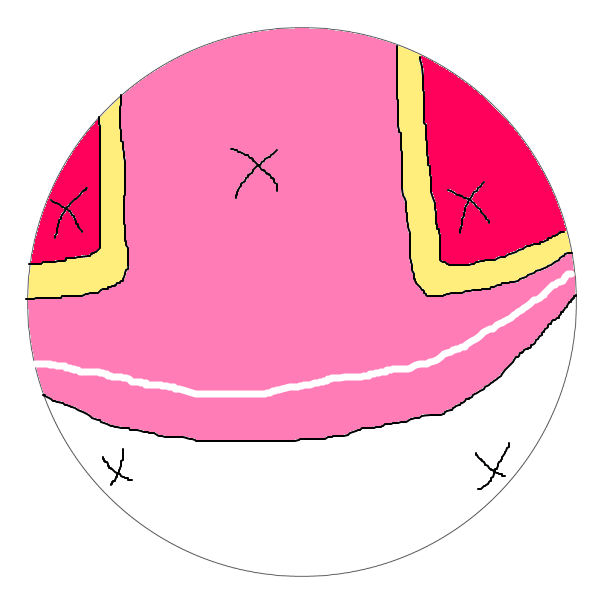 Toadette Overinflated By Theinflatedguyfan On Deviantart