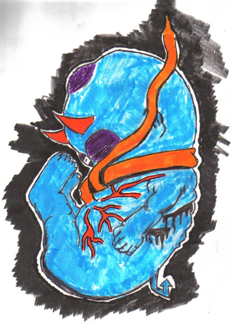 devil fetus by spawnofnoodlesfetus on DeviantArt