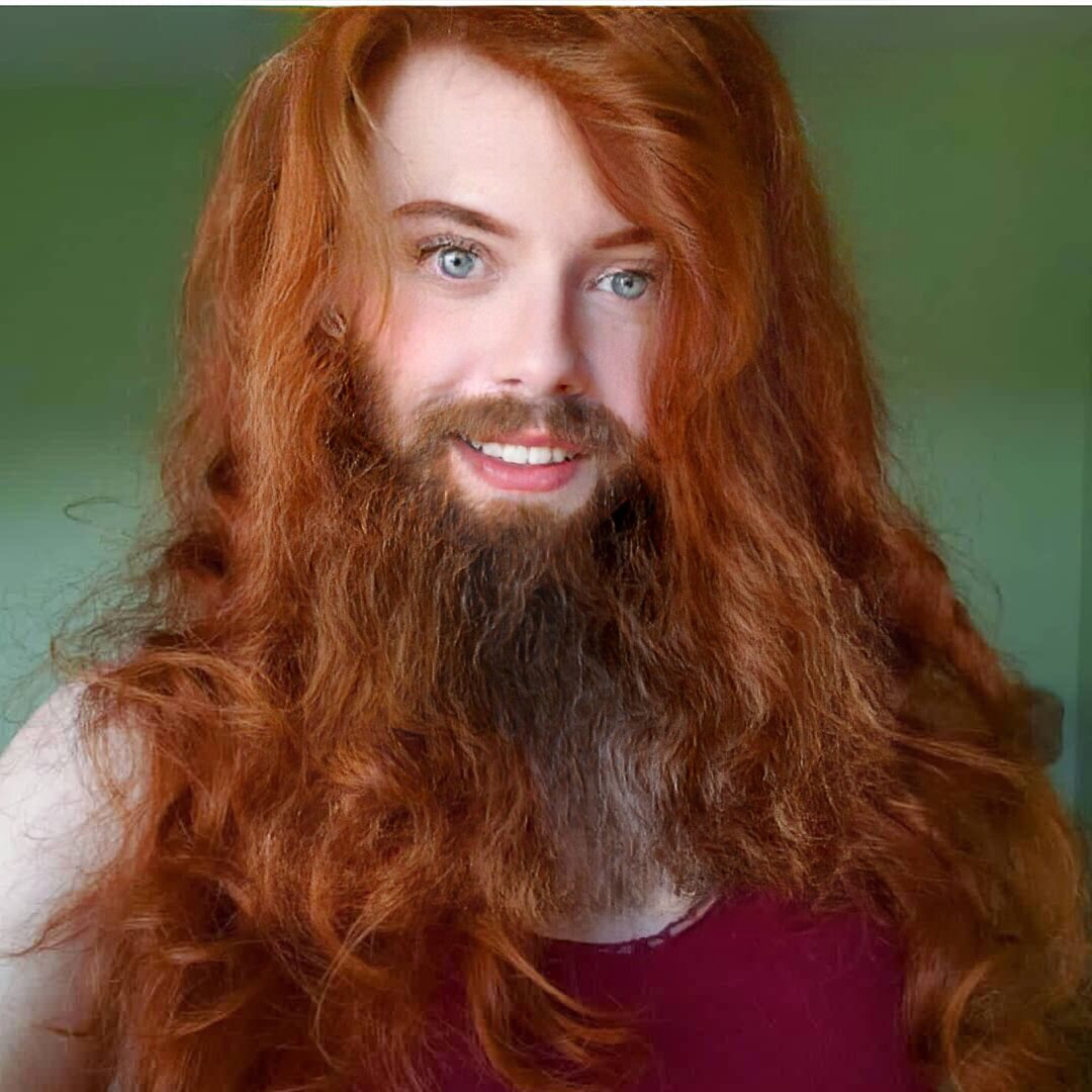 Redhead Facial Hair 14 By Dino233 On Deviantart