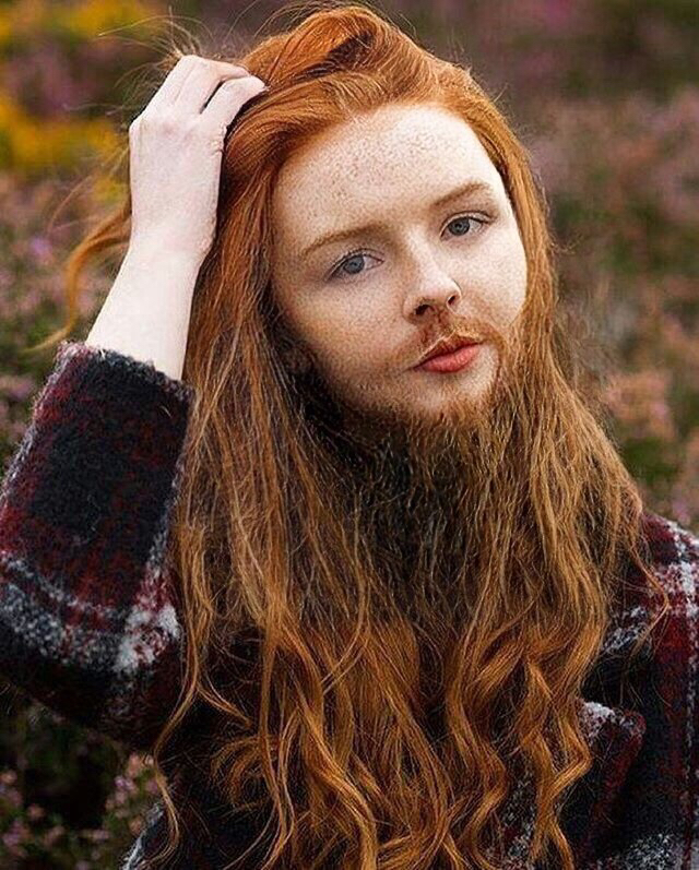 Redhead Facial Hair 17 By Dino233 On Deviantart