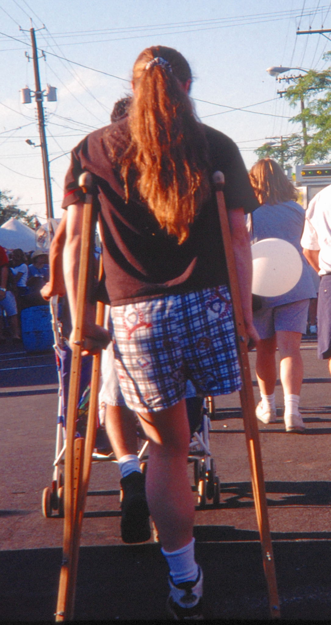One Leg Amputees Sak Shd Sbk On Disabled Women Deviantart