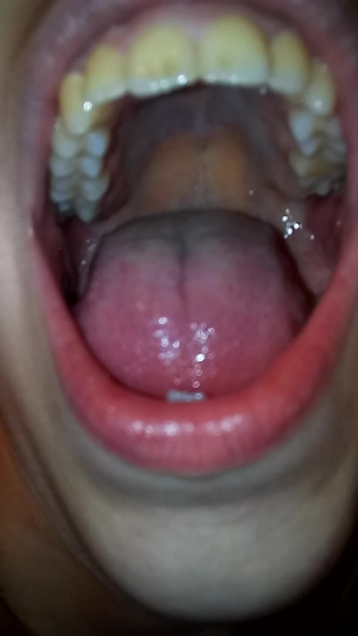 shrunk tiny falling into giantess mouth vore! by tvlb on DeviantArt shrunk tiny falling into giantess mouth vore! by tvlb on DeviantArt