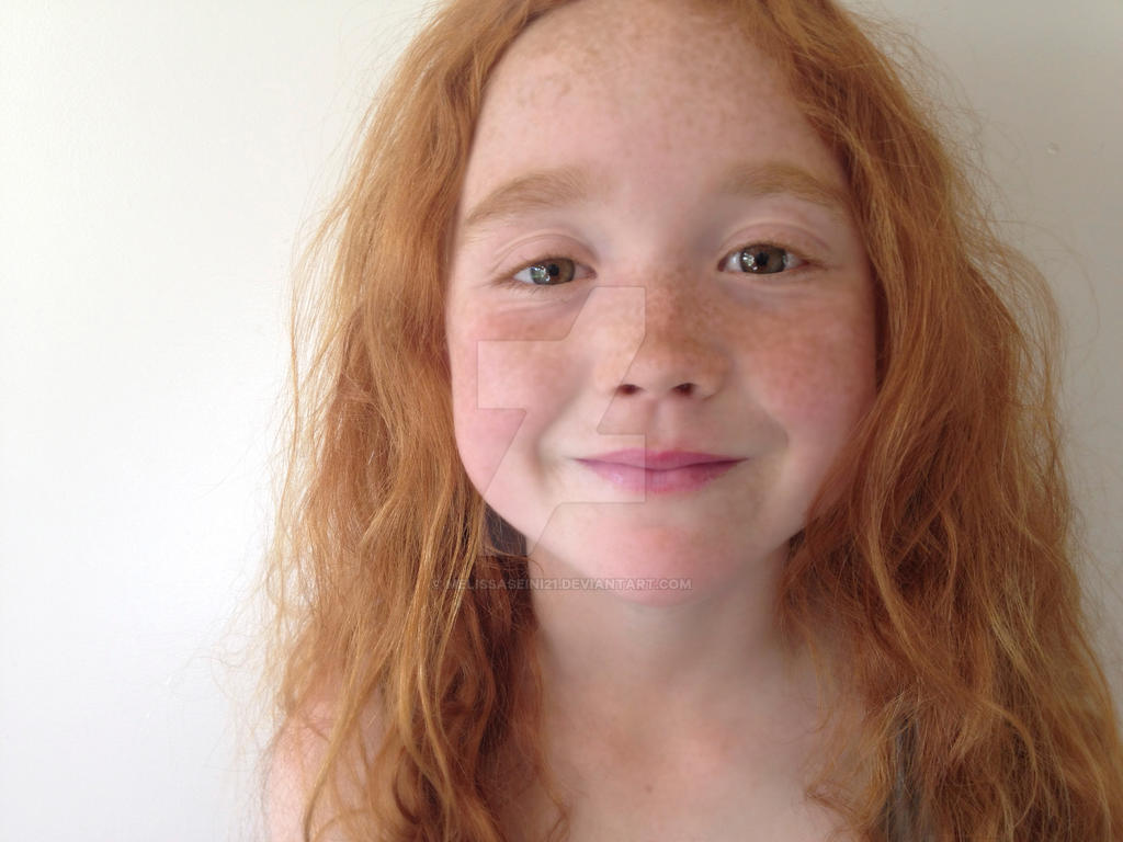 Facial Retouching Image1 By Melissaseini21 On Deviantart
