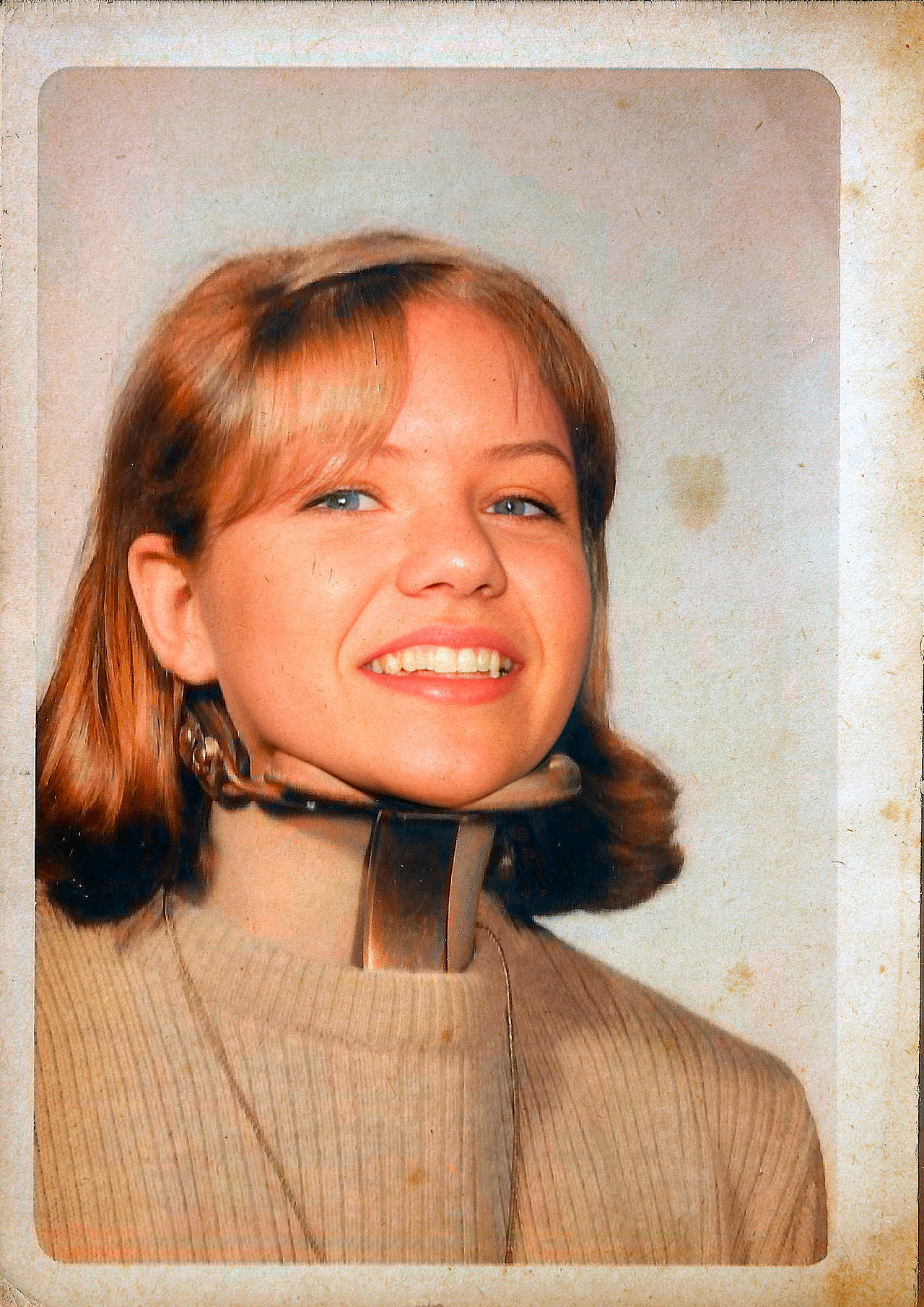 Found Picture A Girl In Milwaukee Brace By Defornia On Deviantart