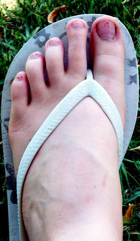 Flipp Flops By Spidergirl21 On Deviantart