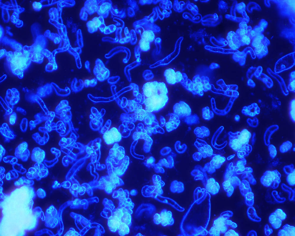 embryonic cell culture -blue- by boxmonkey on DeviantArt