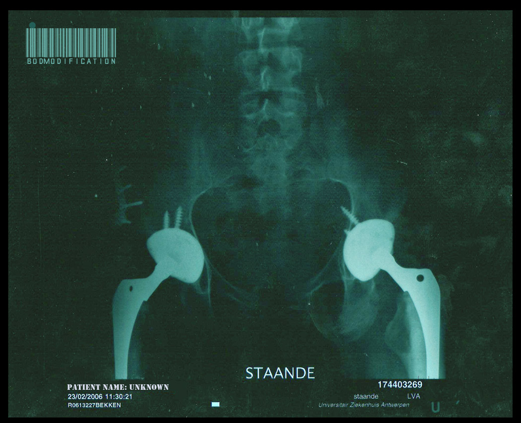 bod mod by moshpithero on DeviantArt