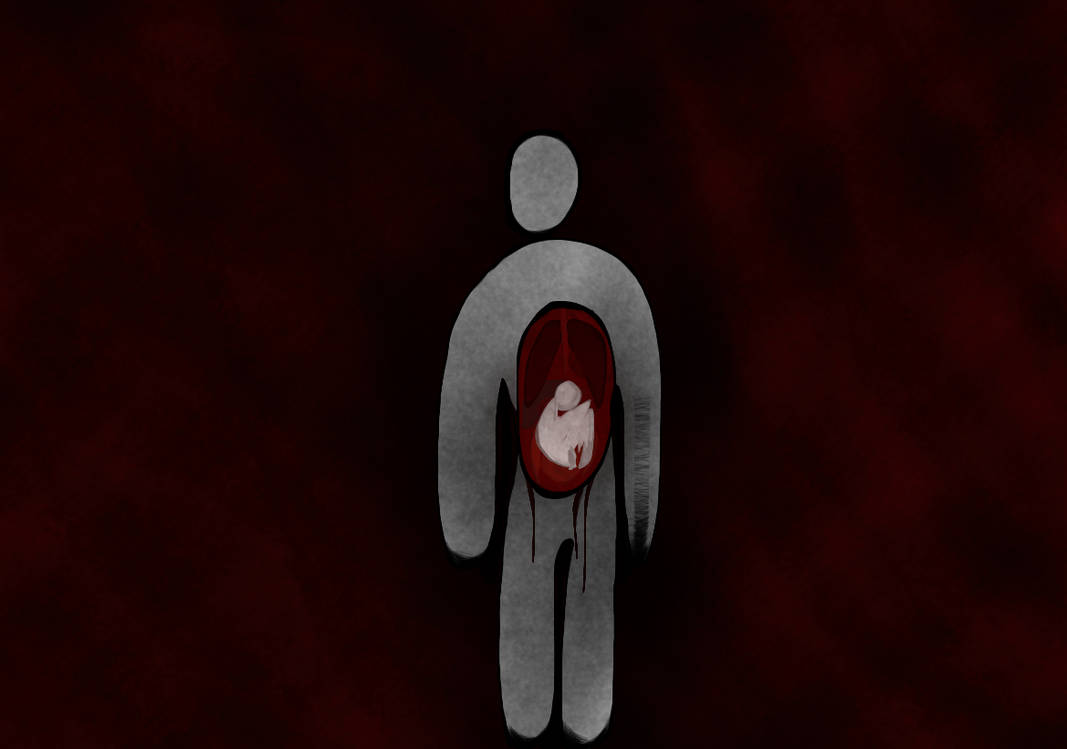 Scp 051 By Rederic7 On Deviantart