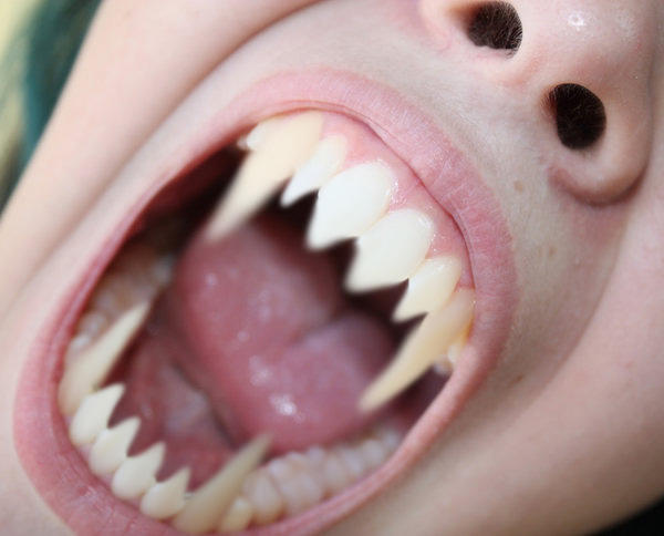 Werewolf Teeth By Lexy3643 On Deviantart