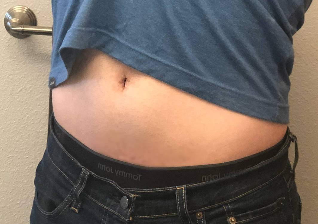 Bellybutton Roleplay By Anonymousbutton On Deviantart