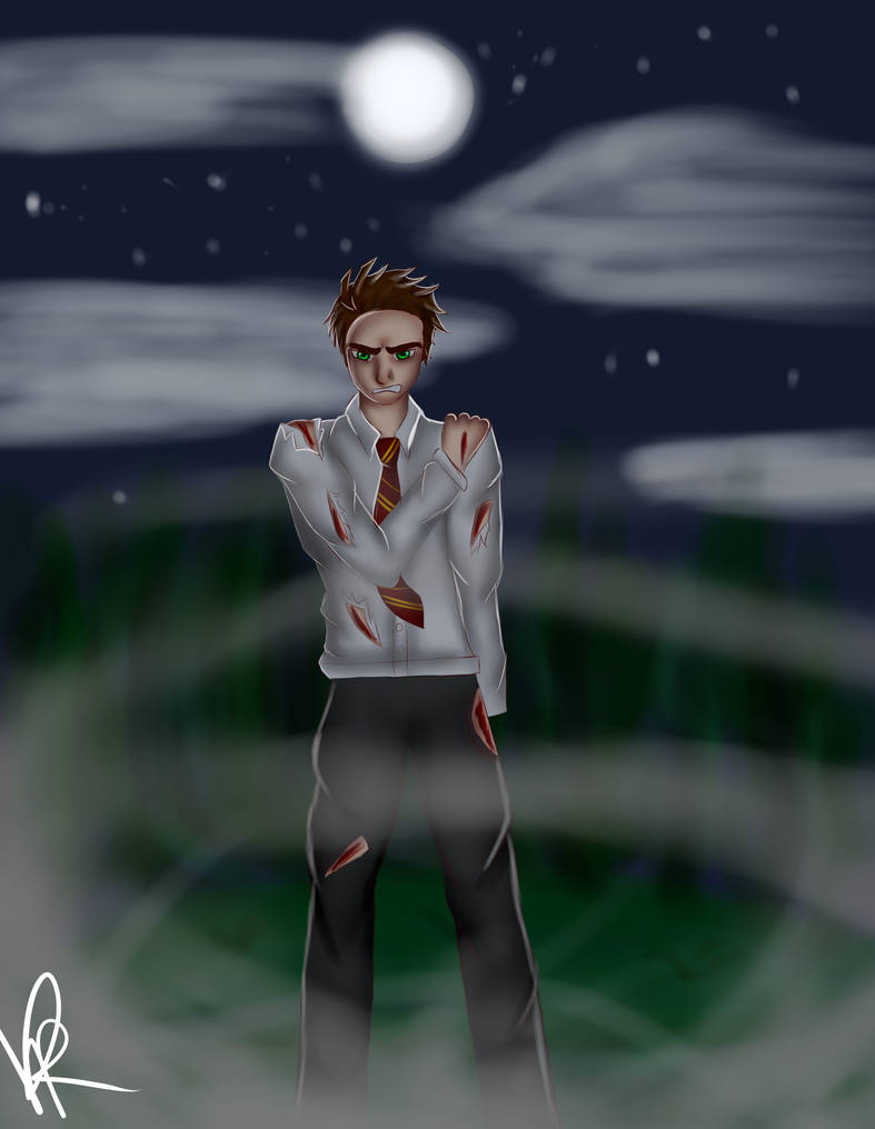 Bitten By Valscar Arts On Deviantart