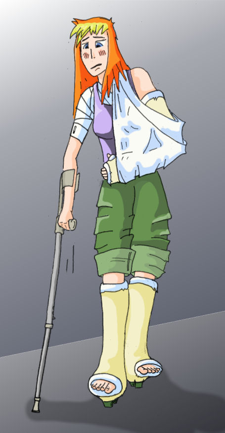 Walking on casts. by excilion on DeviantArt