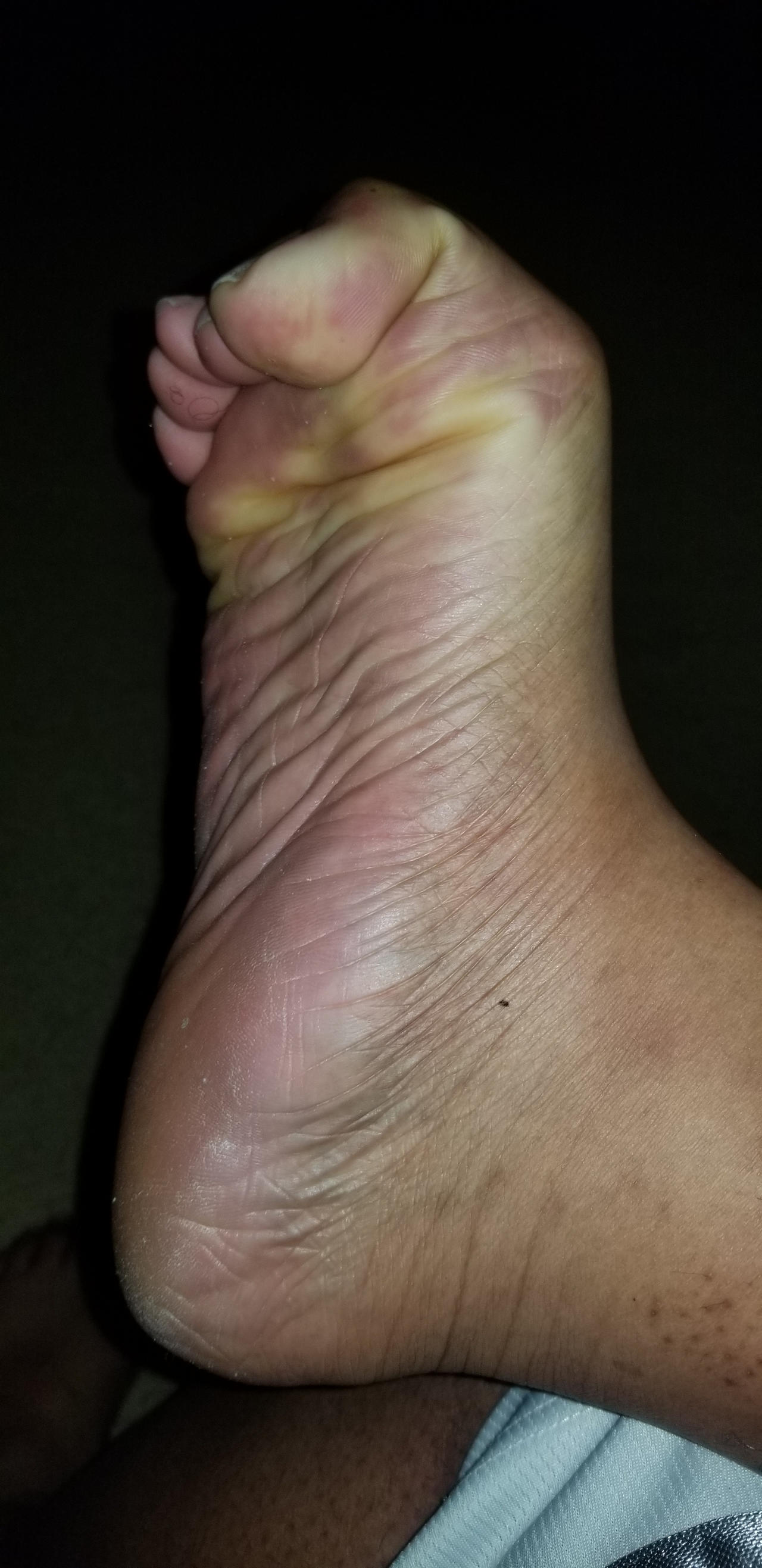 My Scrunched Foot by KungFlew2013 on DeviantArt My Scrunched Foot by KungFlew2013 on DeviantArt