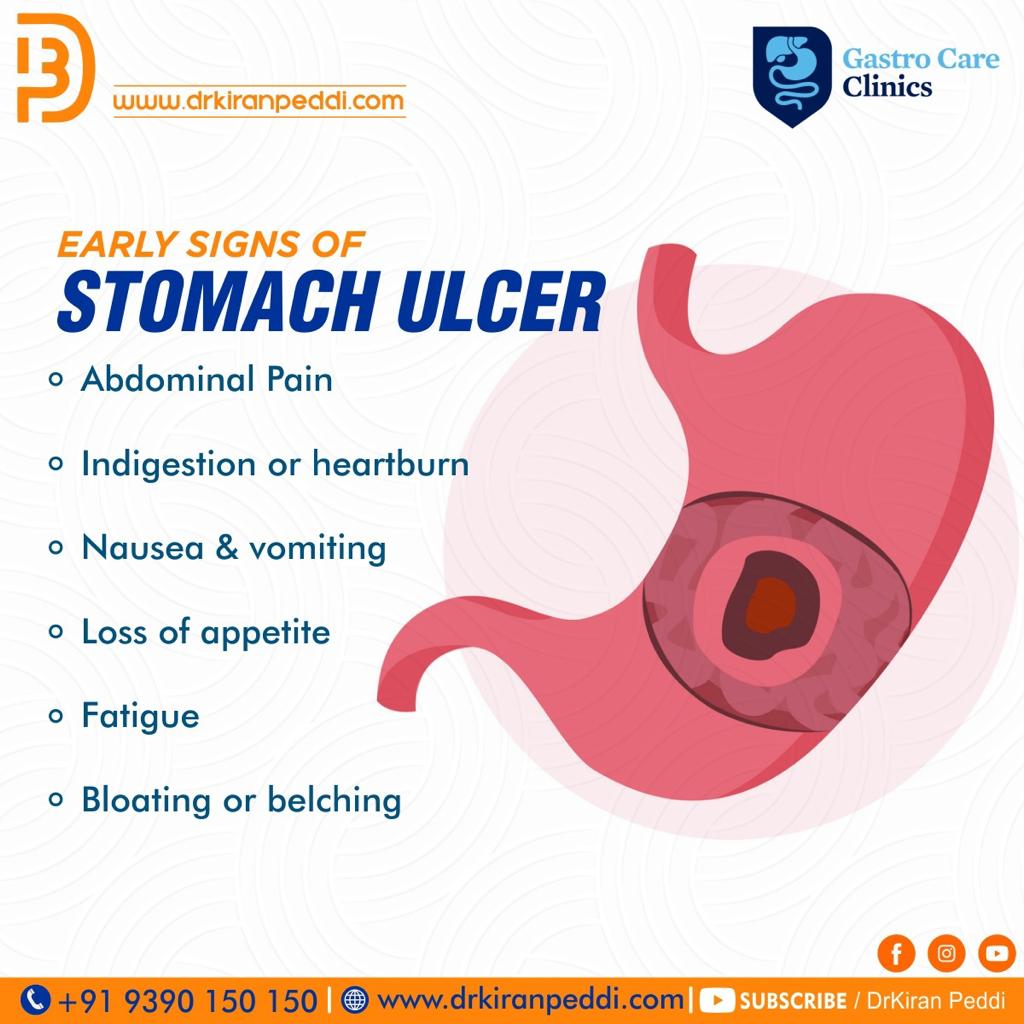 Stomach-ulcer-dr-kiran-peddi by drkiranpeddiinfo on DeviantArt Stomach-ulcer-dr-kiran-peddi by drkiranpeddiinfo on DeviantArt