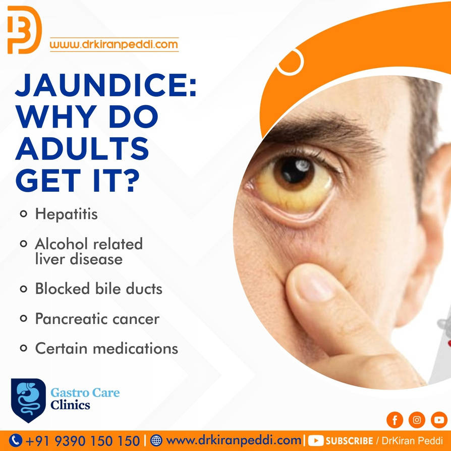 Jaundice Specialist In Hyderabad Dr Kiran Peddi By Drkiranpeddiinfo On