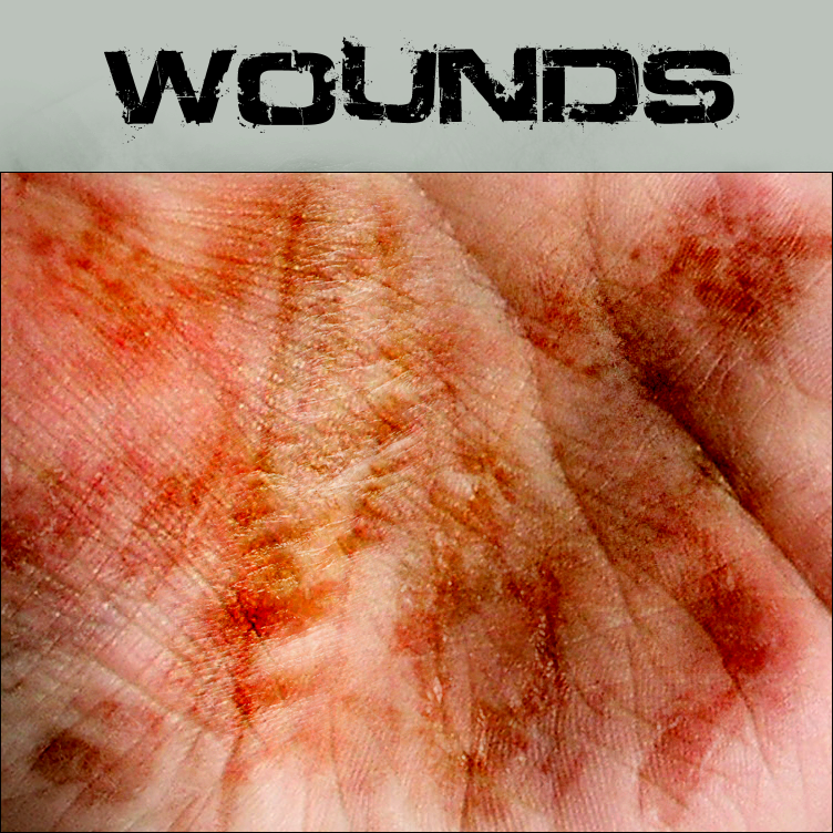wounds by trisste-brushes on DeviantArt