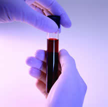 Four Vials by ViaWires on DeviantArt