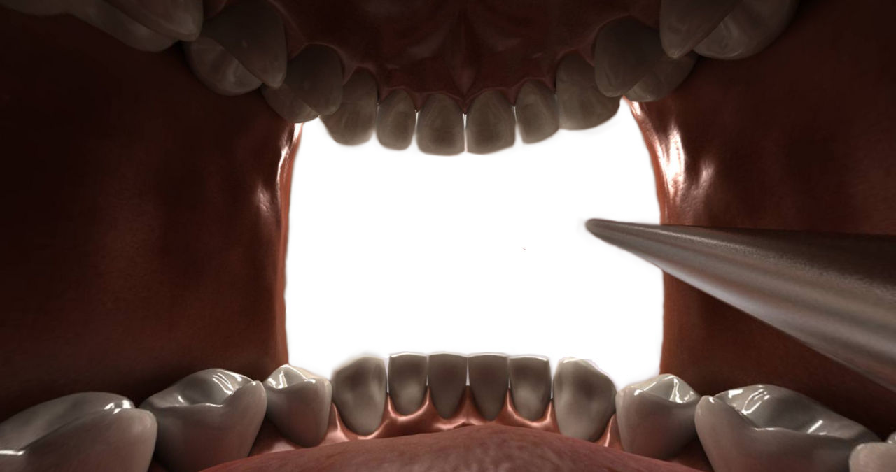 Inside Mouth View - The Dentist by GT647 on DeviantArt