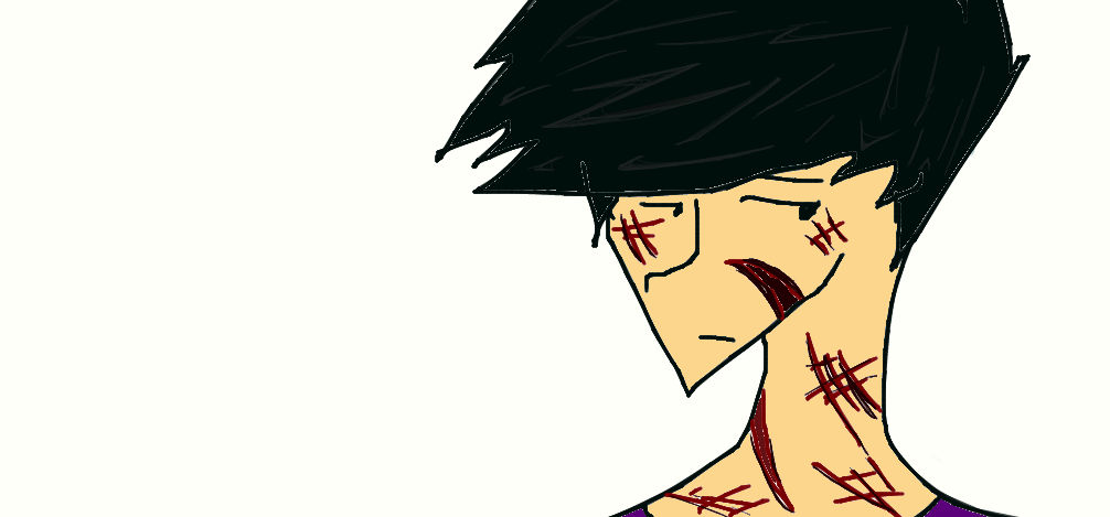 Scars run deep by Derptyderpderpderp on DeviantArt