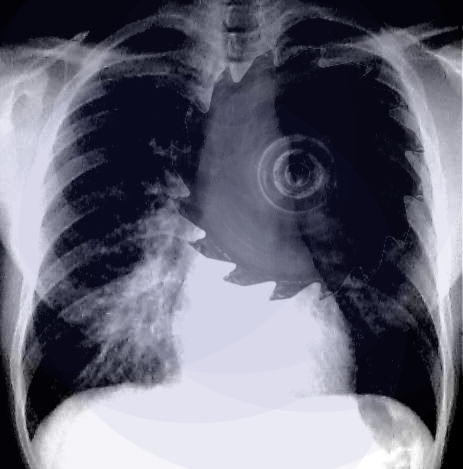 Surgical Mishap by burning-shark on DeviantArt