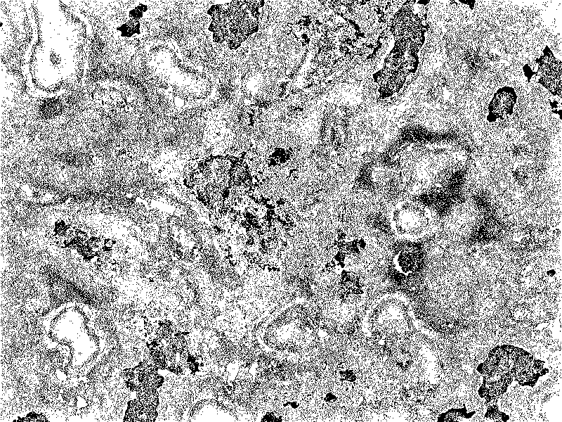 stencile corl by Vincent-JD on DeviantArt