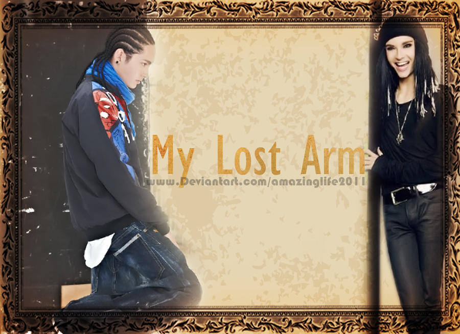 My Lost Arm pt16 by amazinglife2011 on DeviantArt