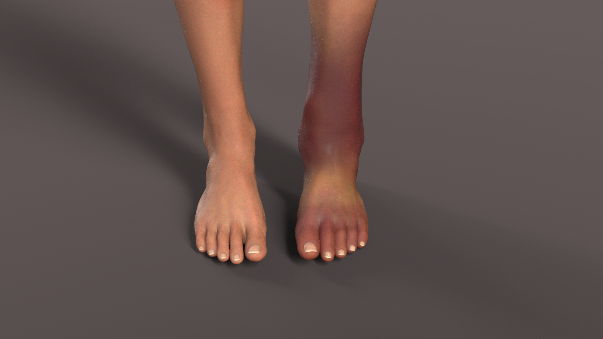 Free Daz Morphs (Gamty Injury morph and LIE G8) by Gamtrulia on DeviantArt