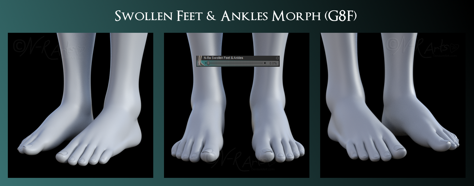Freebie: N-Ra Swollen Feet and Ankles Morph by N-RArts on DeviantArt