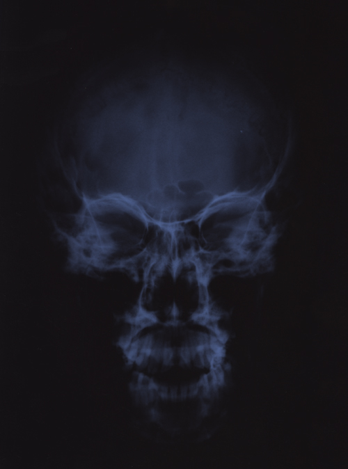 X -ray skull by mzperx on DeviantArt