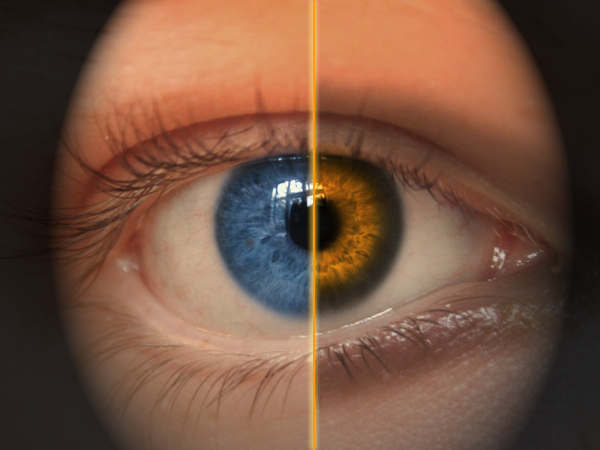 Split Colored Eyes
