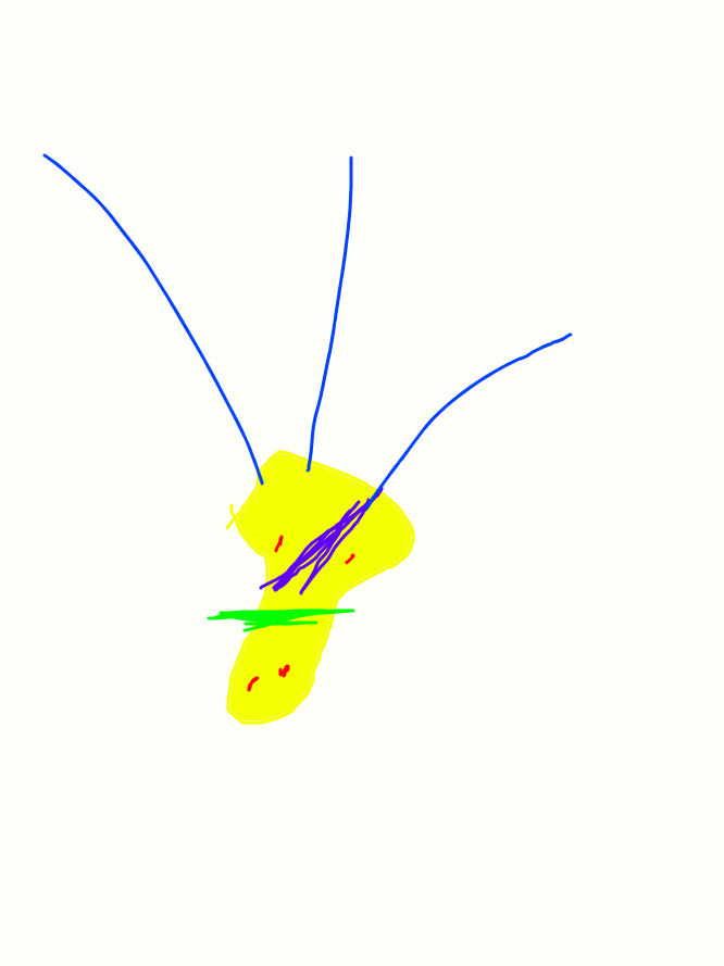 Party Popper by ihatemyparentsloss on DeviantArt