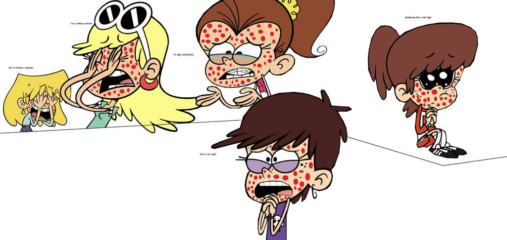 Lori Leni Luna Luan Lynn Got Acne by Kabutopsthebadd on DeviantArt